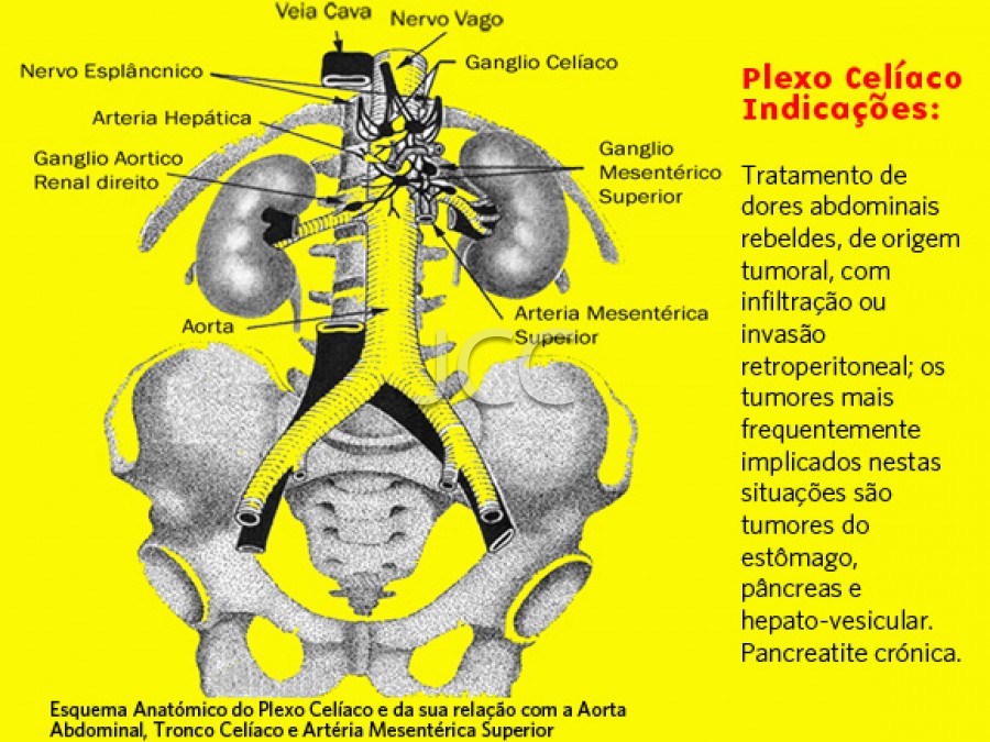 Radiologia de Intervenção - JCC - João Carlos Costa Diagnóstico por Imagem